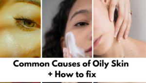 11 Most Common Causes of Oily Skin + How to fix - Bellflower Lifestyle