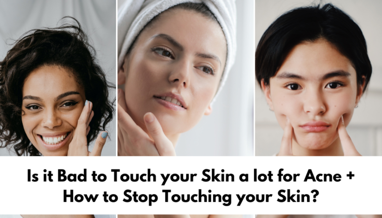 Is it Bad to Touch your Skin a lot for Acne + How to Stop Touching your ...